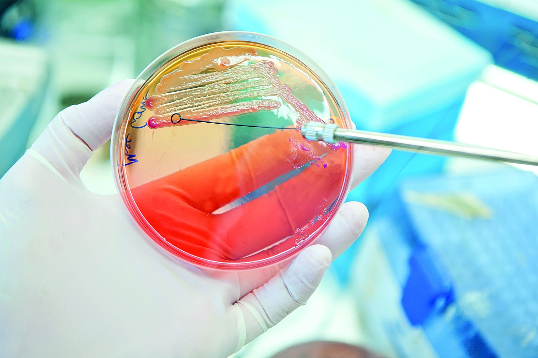 The Wide Application of Escherichia coli Fermentation in ...