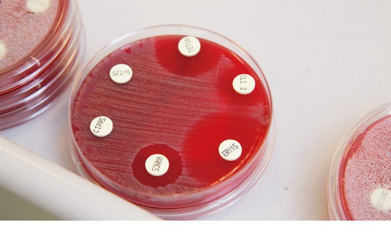 Antibioticaresistentie: de laatste technieken voor een snelle diagnose ...